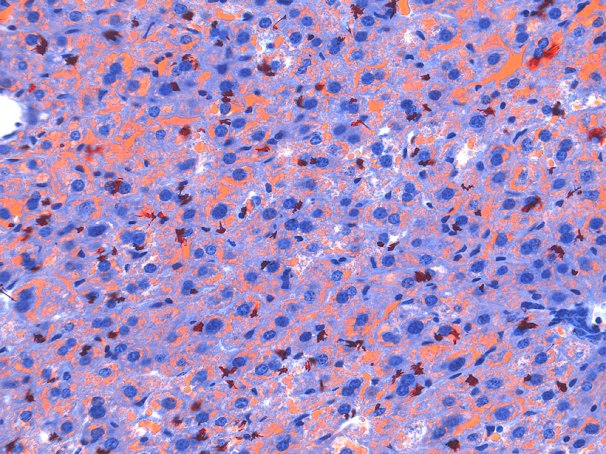 Histology services & histotechnique | Plastic/resin embedding | AnaPath