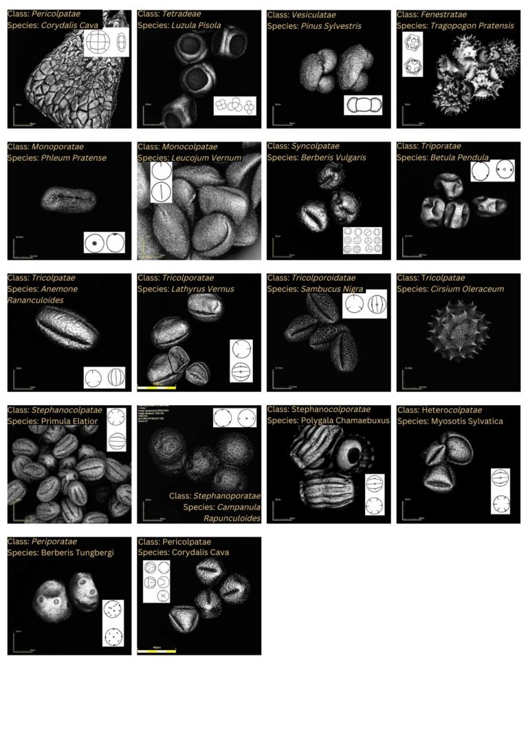 Plant Pollen Identification and Characterization - AnaPath